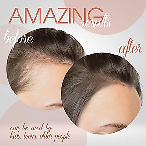 Dr Truth Batana Oil for Hair Growth - 100% Raw Organic, Hair Loss Treatment | Enhances Hair Thickness, Increase Volume, Restored Damaged Scalp, Prevents Hair Loss, Frizz, Split Ends 3.4 oz