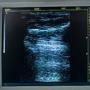 Veterinary Ultrasound Scanner HandScan V8 for Pregnancy Digital Veterinary Ultrasonic Scanner Machine with Convex Probe for Farm Animals Pet - US New Version