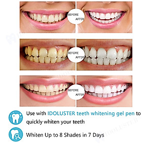 IDOLUSTER Teeth Whitening Accelerator Light, 16X Red & Blue LED Teeth Whitening Light, Powerfull Teeth Light with Comfortable Mouth Tray, Connected with iPhone/Android/USB at Home Use