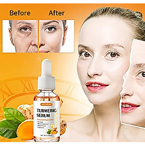 Turmeric Serum for Dark Spots Remover, Turmeric Dark Spot Corrector Serum for Face & Body, Anti Aging Facial Serum for Women and Men, Skin Care Moisturizing Repair Serum, Improve Skin Tone (1Fl Oz)