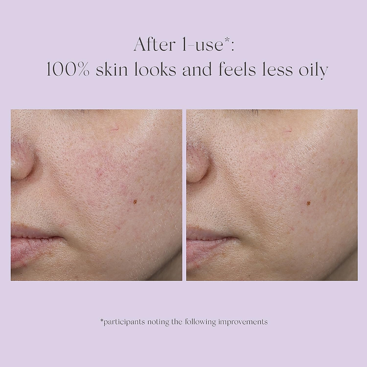 EXUVIANCE Performance Peel AP25 At-Home Chemical Peel with Glycolic, Mandelic and Polyhydroxy Acids, 13 ct.