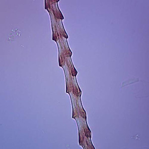 Hair Comparison Microscope Slide Set