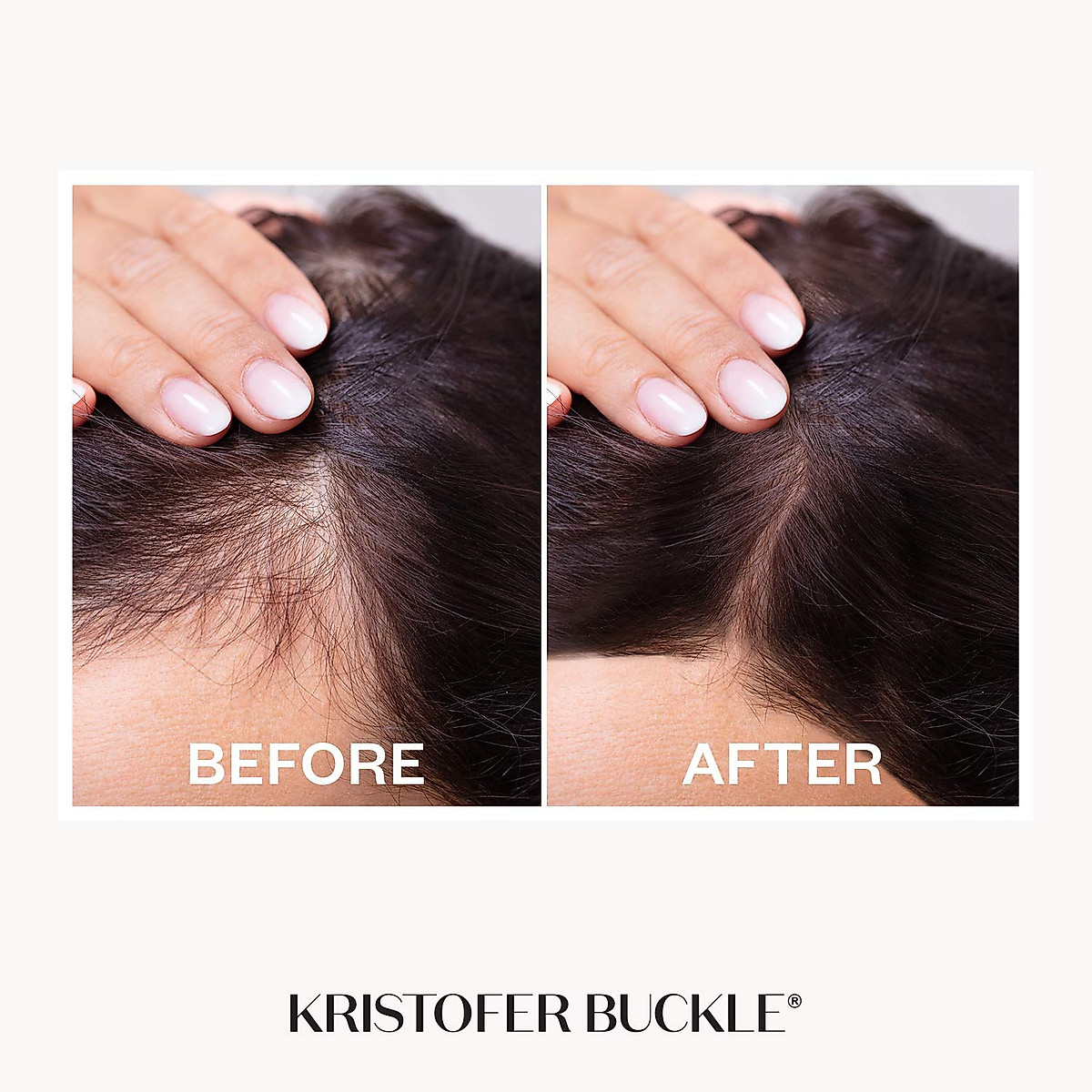 KRISTOFER BUCKLE Full Disclosure Scalp Cover Duo, 0.39 oz. | Camouflaging Cream Conceals Sparse, Thinning Hair & Bald Spots | Brunette