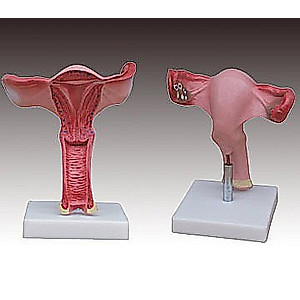 Model Anatomy Professional Medical Uterus Magnified New IT-086 ANGELUS