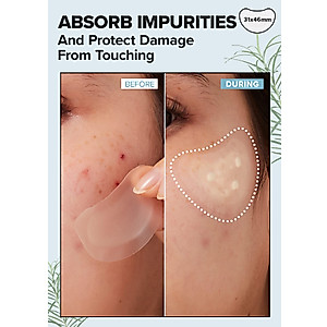 I DEW CARE Hydrocolloid Acne Pimple Patch - Timeout Blemish Chin & Chicks + Timeout Blemish Happy Paws Bundle