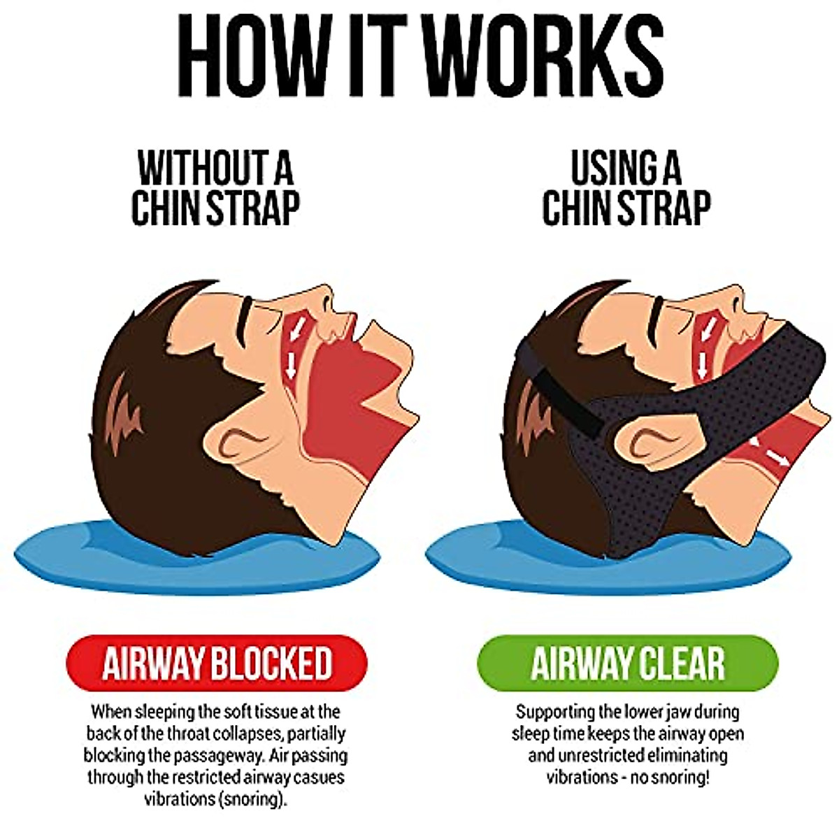 AVEELA Anti Snoring Chin Strap for CPAP Users | Large | Keep Mouth Closed While Sleeping | Adjustable Premium Snore Stopper Head Strap for Men and Women | Itch-Free Material for Uninterrupted Sleep