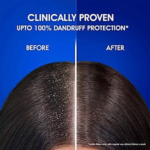 Head &amp; Shoulders Anti Dandruff Cool Menthol Shampoo, 340ml