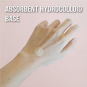 Bug Bite Itch Relief Patch FSA Eligible, Summer Travel Essentials for Kids, Mosquito Bug Bite Thing Suction Tool Alternative, Summer Camp Essentials Itch Relief, Baby hydrocortisone Cream Alternative