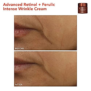 Dr Dennis Gross Celebrate Smooth Kit: Advanced Retinol + Ferulic Texture Renewal Serum, Triple Correction Eye Serum & Intense Wrinkle Cream (0.5 fl oz each)