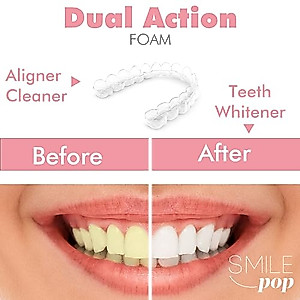 Smile Pop Mint Aligner Cleaner & Whitener Foam for Invisalign Cleaner, Dentures and Essix Trays. Retainer Cleaner Contains Hydrogen Peroxide, Fights against Bad Breath, Brightens teeth and Kills Germs