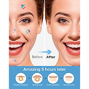 LitBear Acne Patch Pimple Patch, Rainbow Star & Heart Shaped Acne Absorbing Cover Patch, Hydrocolloid Acne Patches For Face Zit Patch Acne Dots, Tea Tree Oil + Centella, 108 Patches, 14mm & 10mm