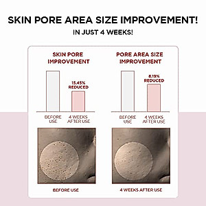 SKIN1004 Madagascar Centella Poremizing Clear Toner 7.1 fl.oz(210ml) | for Keratin Plug | for Sensitive Skin