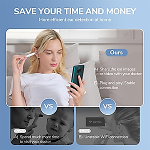 ScopeAround Otoscope, 3.9mm Ultra-Thin Ear Camera with 6 LED Lights, Digital Otoscope with Ear Wax Removal Tool, USB Plug & Play Ear Wax Camera Compatible with iPhone 15/Android