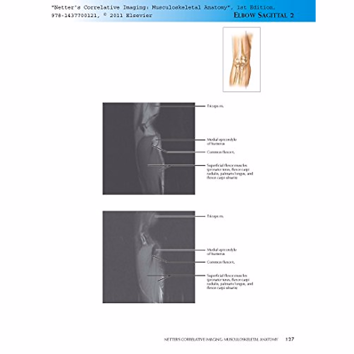 Netter's Correlative Imaging: Musculoskeletal Anatomy: with Online Access at www.NetterReference.com (Netter Clinical Science)
