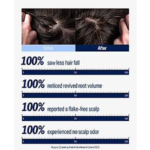 DASHU Revitalizing Protein Shampoo for Dry, Itchy Scalp, Thinning Hair, and Men - 16.9 fl oz