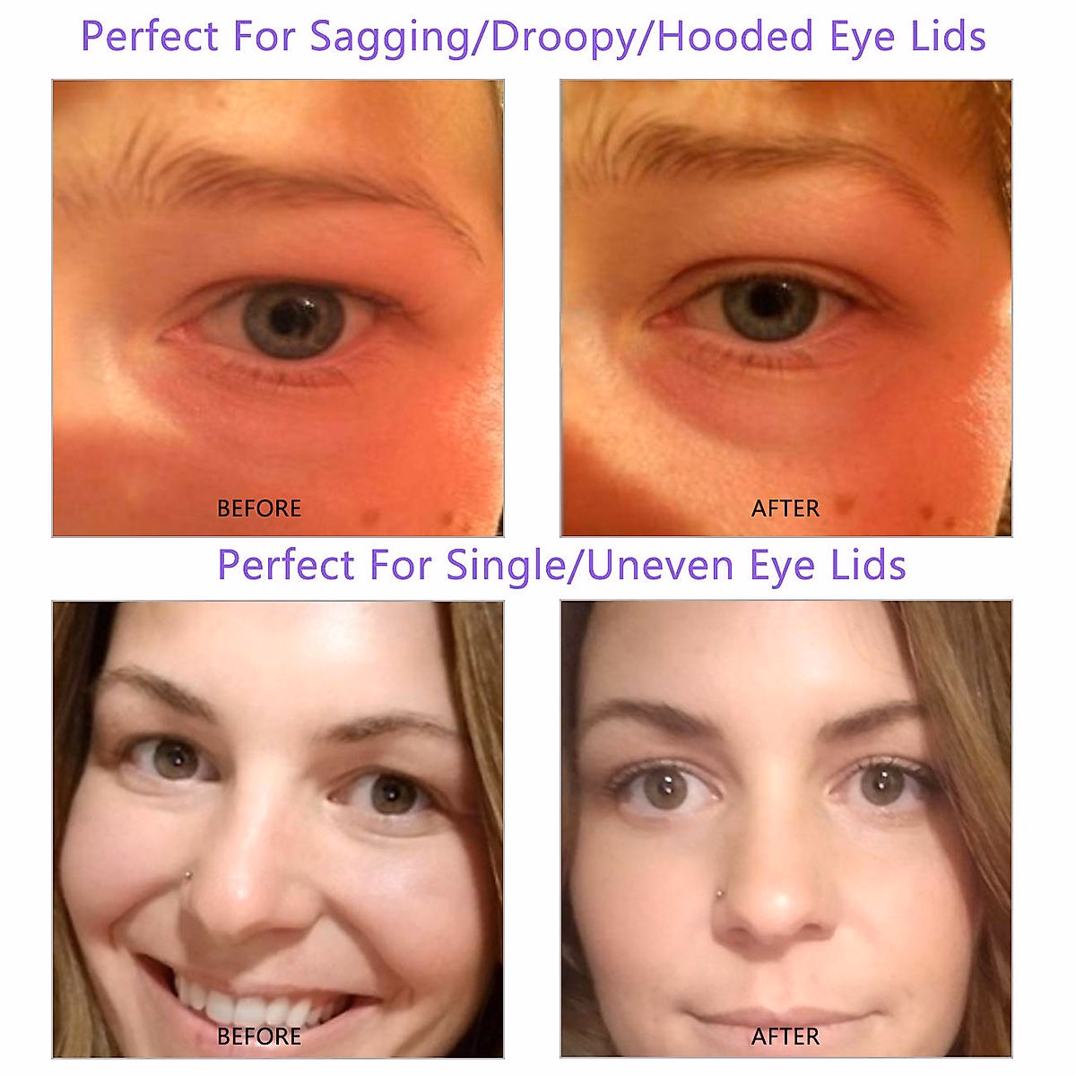 336Pcs Invisible Single Side Eyelid Tape Stickers, Eyelid Lifter Strips for Droopy Hooded Eyes, Eyes Makeup, Uneven Mono-eyelids