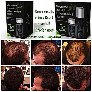 Meantime Thin Hair Enhancement Fibers (Dark Brown): Pliable Hair Enhancement Product for Receding Hairline & Overall Thinning - Thickens & Cover Maximum Areas, Makes Thin Hair Thick. Quick