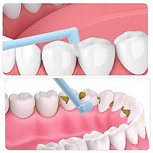 Patelai 6 Pieces End Tuft Toothbrush Soft Interdental Brushes Tooth Stain Remover Trim Toothbrush Single Brush for Implants Teeth Detail Cleaning Supplies(Bright Colors)