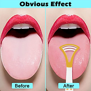 Tongue Scraper Cleaner Soft Tongue Scraper for Healty Oral Care,maxin 6PCS Tongue Cleaner Oral Health Tools for Adult Kids