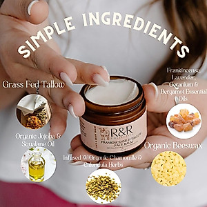 Handmade Tallow Face Moisturizer- 100% Grass Fed Beef Tallow for Skin Care- Handmade Whipped Frankincense and Tallow Balm- Sensitive & Dry Skin, Eczema, Psoriasis- 2 FL. oz. (Frankincense Face)