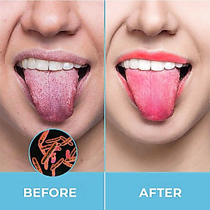 Tongue Scraper for Adults by HOKIN (2Pcs Oral Care Pack) Stainless Steel Tongue Cleaners Reduce Bad Breath 100% Metal Tough Scrapers Men and Women Hygiene Product