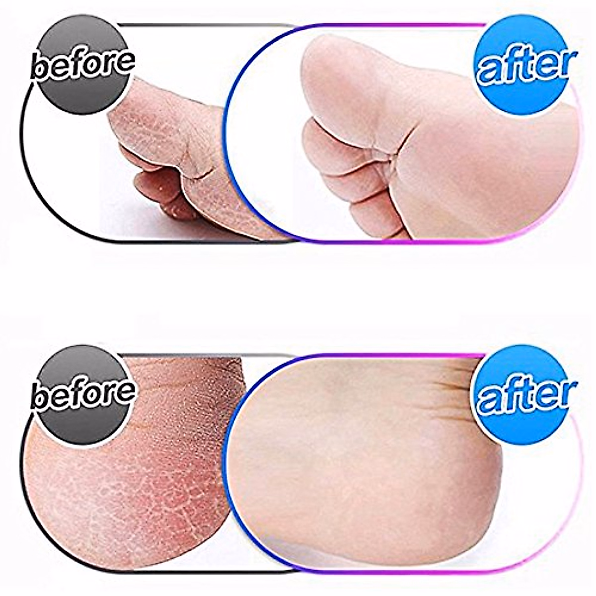 4 Pack Replacement Roller Refills Compatible with Scholl Express Pedi Foot Smoother-Extra Coarse