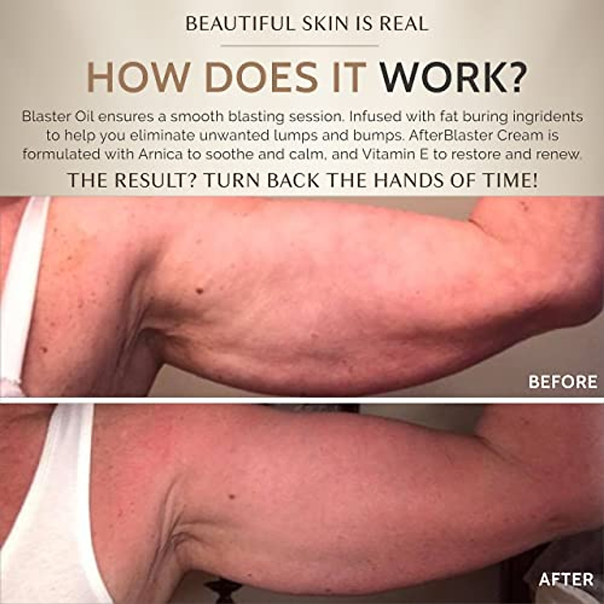 The Blaster Oil and After Blaster Cream by Ashley Black. Use with FasciaBlasting for Maximum Results. Blaster Fat Burning Oil and Soothing Arnica and Skin Tighteners for Post FasciaBlast