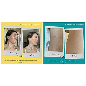 Plant-Based Kale Face Body Exfoliating Scrub Mask for Keratosis Pilaris Treatment, Strawberry Legs Treatment, Cellulite, Stretch Marks, Blackheads