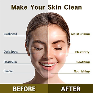 Purederm Gold Emu Hydro Pure Gel Mask (5 Pack) Hydrogel Face Mask for Nourishing & Revitalizing