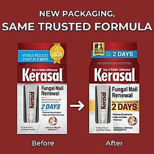 Kerasal Nail Renewal, Restores Appearance of Discolored or Damaged Nails, 0.33 fl oz (Packaging May Vary)