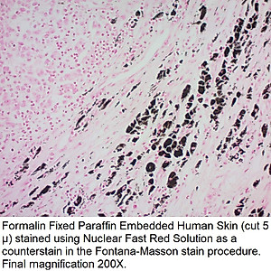 Nuclear Fast Red Solution, 1 Gallon