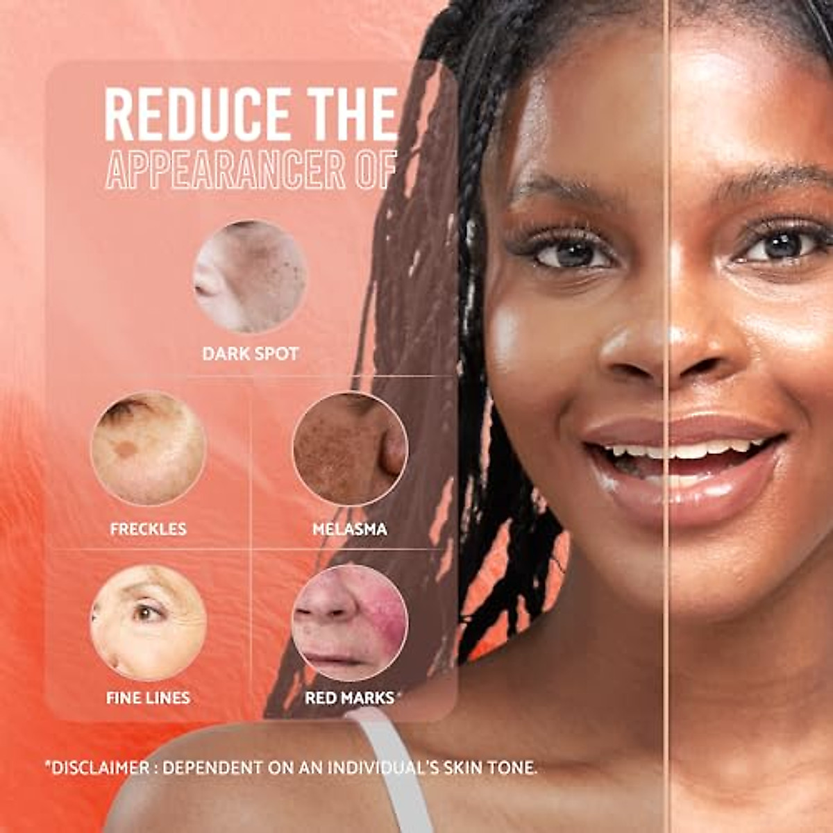 Koji White Pure Kojic Acid Skin Brightening Soap for Pigmentation with Hyaluronic Acid, Vitamin C - Even Tone Cleansing Bar, Sun Damage Skin with Tea Tree, Coconut Oil, Vegan, 2.82 oz (2 Bars)