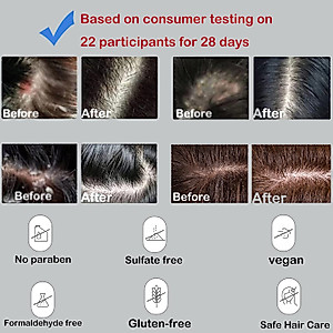 Voir Haircare Rhythm of the Rain Calming Glacial Leave-in Scalp Serum 1.0 Fl Oz