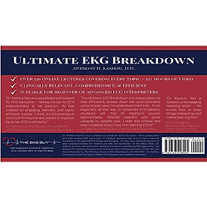 Ultimate EKG Breakdown - The EKG Guy