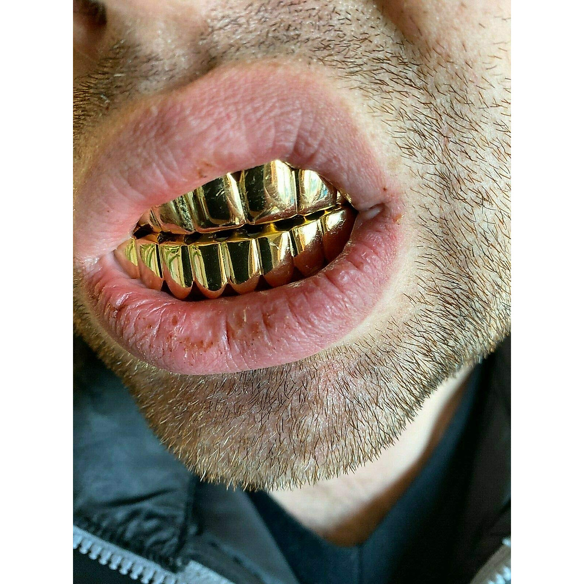 Solid 925 Sterling Silver Real Grillz - 14k Gold Plated - Custom Top & Bottom Grills For Teeth - Real Solid Silver NOT BRASS