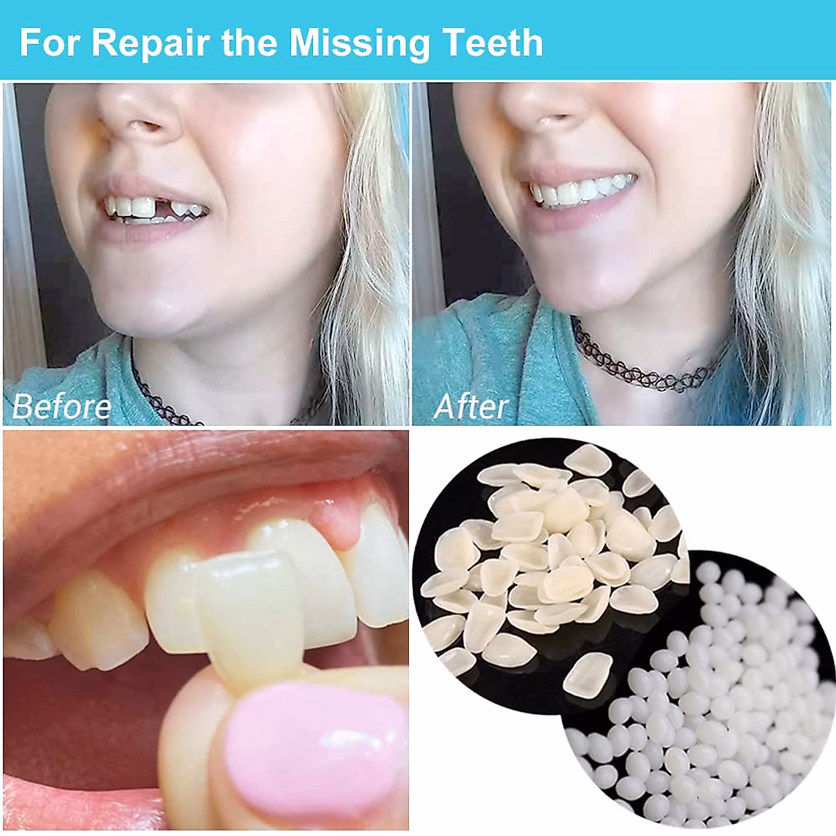 Brige Tooth Repair kit for Filling The Missing Broken Tooth and Gaps-Moldable Fake Teeth and Thermal Beads Replacement Kit