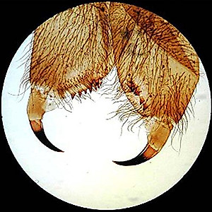 AmScope PS100D Prepared Microscope Slide Set for Basic Biological Science Education, 100 Anatomy and Botany Slides, Set D, Includes Fitted Wooden Case