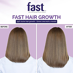 NISIM F.A.S.T Fortified Amino Scalp Therapy Shampoo & Conditioner- Promote Fast and Healthy Hair Growth (10 Ounce /300 Milliliter)