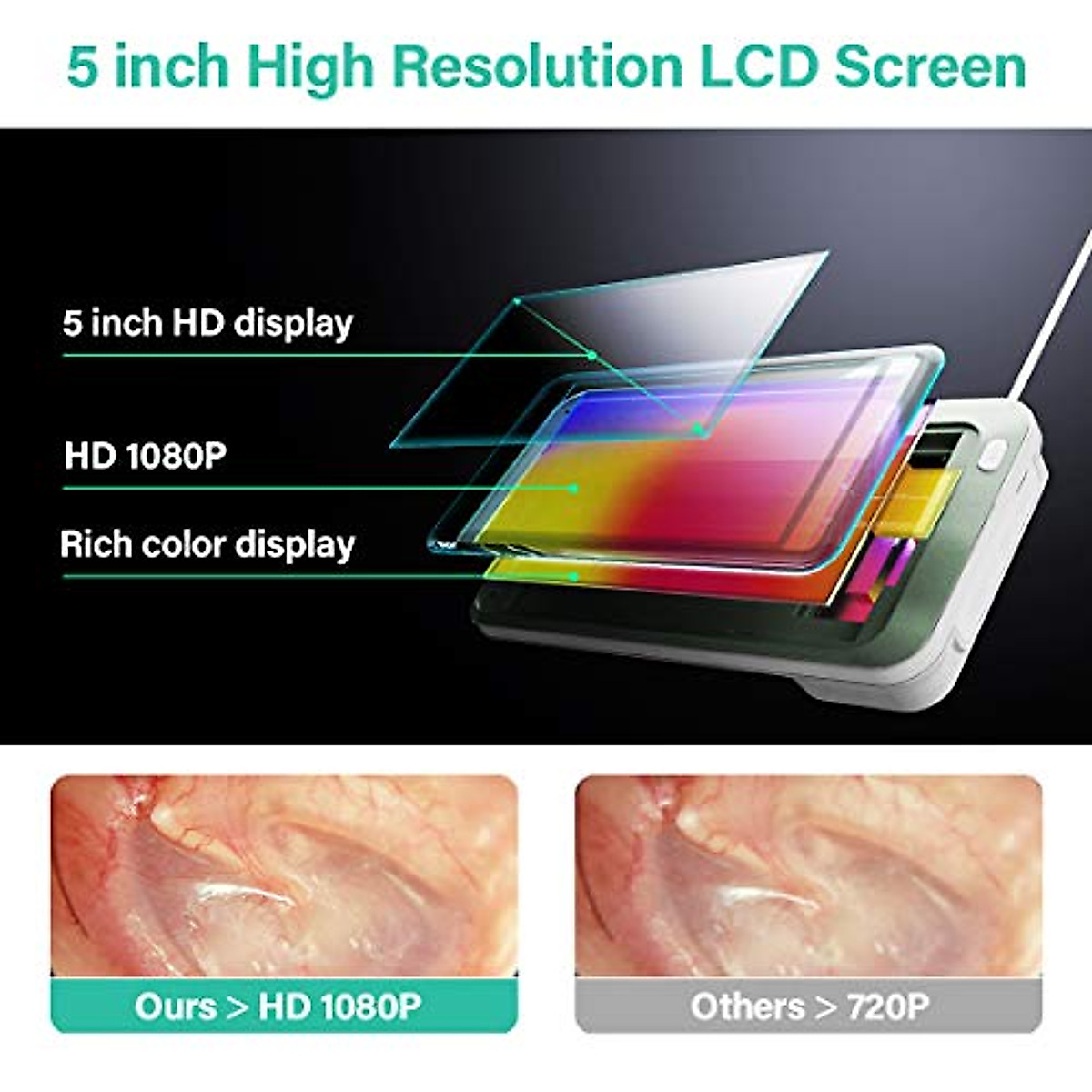 Ear Wax Removal Otoscope,Sinohrd Ear Camera with 5 Inch 1080P HD Screen Ear Scope Otoscopes,3.9mm Light Lens Inspection Endoscope Ear Wax Removal Tool USB Rechargeable Otoscope