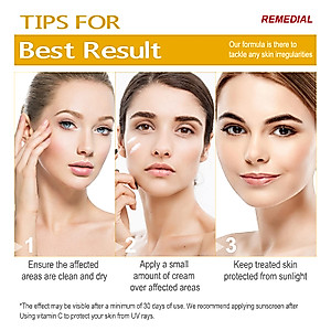 ELBBUB Vitamin C Moisturiser Cream for All Skin Types - for Age Spots and Uneven Skin Tone with 20% Vitamin C - Boost Skin Collagen,Hydrate & Plump Skin, Anti Aging & Wrinkle Facial Cream