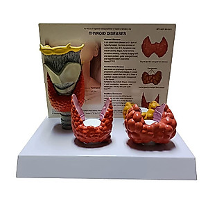 KH66ZKY Thyroid Anatomy Model - Thyroid Nodule Model - for Science Classroom Study Display Thyroiditis Mastoid Cancer Teaching Medical Model
