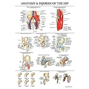 Palace Learning Laminated Anatomy and Injuries of the Hip Poster - Hip Joint Anatomical Chart - 18" x 24"