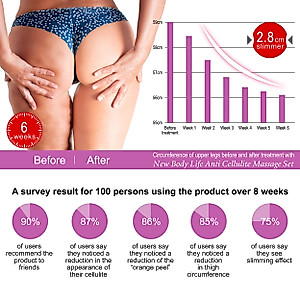 Anti Cellulite Massager Vacuum Suction Cups for Cellulite Treatment - Body Massager, Exfoliator, Cupping Therapy Set - Improve Circulation, Distribute Fat Deposits, Shower Scrubber, Cellulite Remover