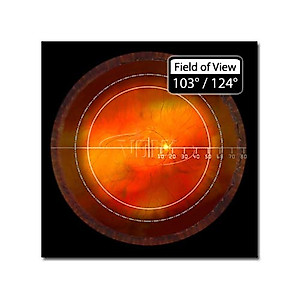 Volk Optical Digital Wide-Field Indirect Ophthalmic Slit Lamp Lens - Blue