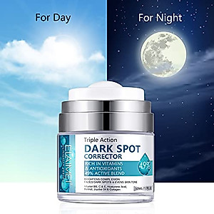 Dark Spot Remover For Face, Dark Spot Corrector and Remover, Sun Spots Melasma Freckle Remover, Packed with vitamins and natural extracts to treat dark spots, age spots, or sunspots (A)