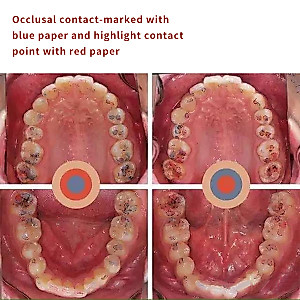 ANNWAH Dental Articulating Paper - Thicker Double Side Bite Paper Strips 100μm Thickness Oral Teeth Care Material Dental Lab Products 300 Sheet/Box…