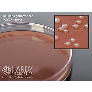 Chocolate Agar, (GC Agar Base with 1 Percent Bovine Hemoglobin and Koenzyme Supplements), for Fastidious Bacteria, 15x100mm Plate, Order by The Package of 10 Plates, by Hardy Diagnostics