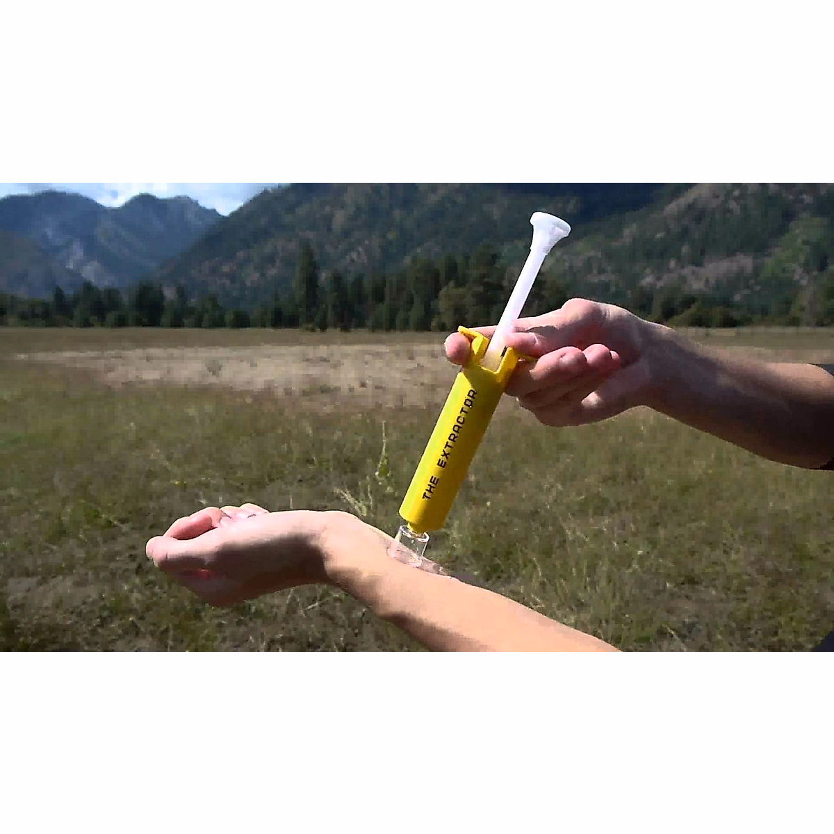 Sawyer Products Venom Extractor & Suction Pump Kit for Snake Bite, & Bee, Wasp, and Mosquito Stings, Yellow, One Size (B4)