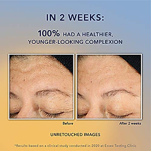 RoC Multi Correxion Revive + Glow Gel Facial Cleanser With Vitamin C, & Glycolic Acid, Paraben-Free, Sulfate-Free Skin Care, 6 Ounces