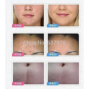 Bepanthen Skin Moisterizer (Moisturizing Cream) 30 Grams